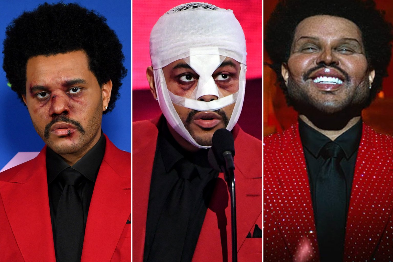 The Weeknd Plastic Surgery 2024 Surgery Journey All Details